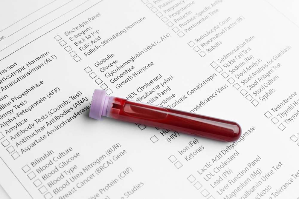 What to Expect During a Blood Exam - Medical Art Laboratory