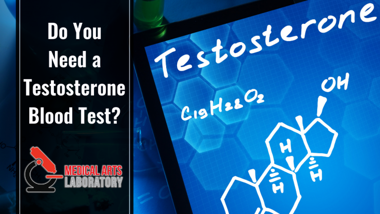Do You Need a Testosterone Blood Test? Check Your Low T Levels!